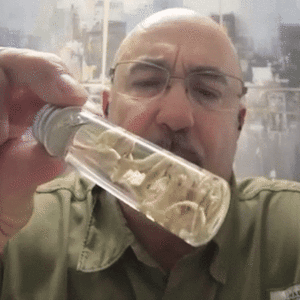 White fibrous clots found in at least 50% of all cadavers embalmed ...